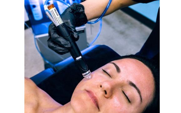 Platinum HydraFacial by Balance Within in Fort Worth, TX - Alignable