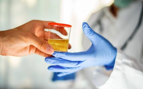 Urine Drug Testing by Fastest Labs of Fort Myers in Fort Myers, FL ... Urine Drug Testing by Fastest Labs of Fort Myers in Fort Myers, FL ...