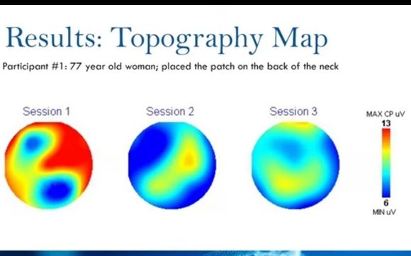 Life Wave's X39 Stem Cell Patches by Life Wave Stem Cell/ Stag Hair ...