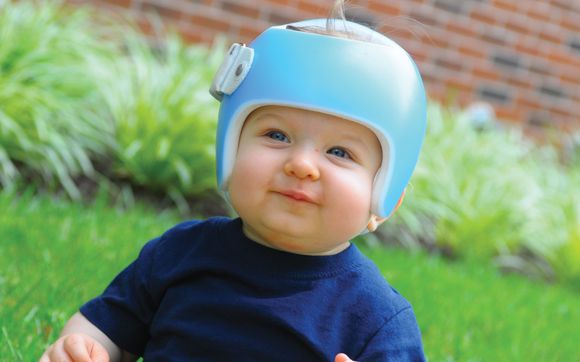 Infant Cranial Helmets by Family Orthotics & Prosthetics in Kearney, NE ...