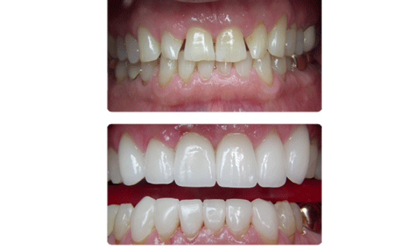 Orthodontic care by Alongi Dental in Huntsville, AL - Alignable