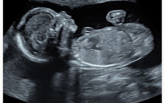 2D ultrasound by Precious Baby Peek Ultrasound in New Bern, NC - Alignable