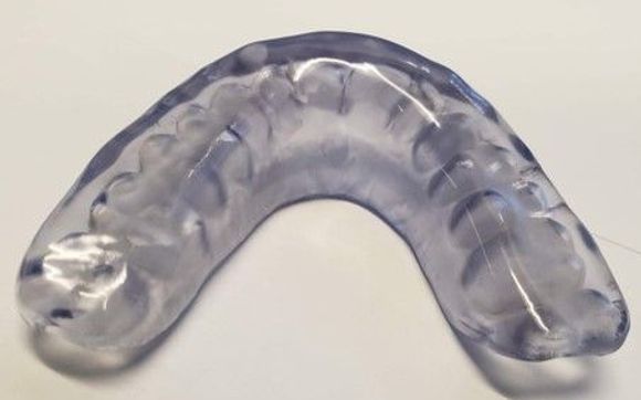 3D Printed Splint/Nightguard by Expert Orthodontic Appliances and New ...