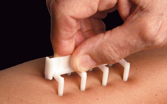 Multi-Test PC (Pain Control) Skin Prick Test device for diagnosing ...