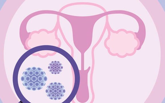 HPV PCR Testing by LabTurbo Biotech Laboratory in West Windsor, NJ ...