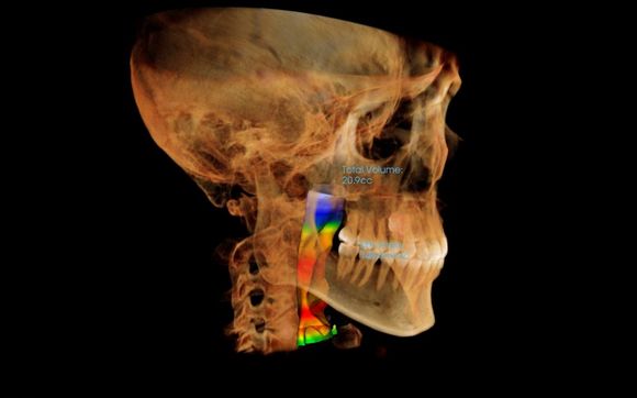 Airway Sleep And Breathing Dentistry By Reclaim Integrative Dentistry