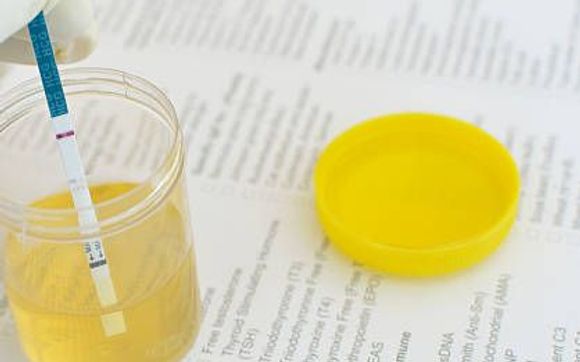 Urine Drug Screen Collection by A Step Above Home Care & ASA Lab/Fingerprinting in Spartanburg ...
